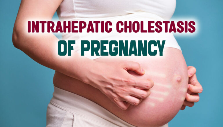 Intrahepatic Cholestasis of Pregnancy - Women's Frame