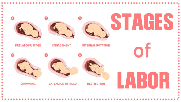 Stages of labor - Women's Frame