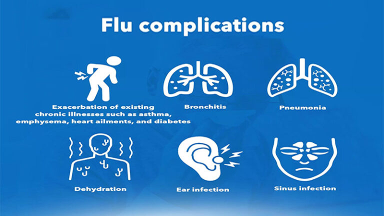 What Are The Symptoms Of Type B Influenza? - Women's Frame
